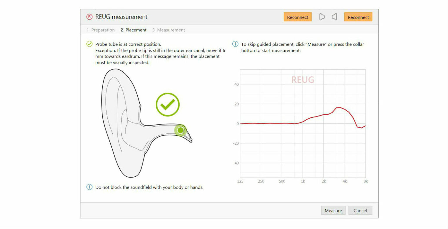 Phonak releases 2nd generation of TargetMatch with Target 5.1